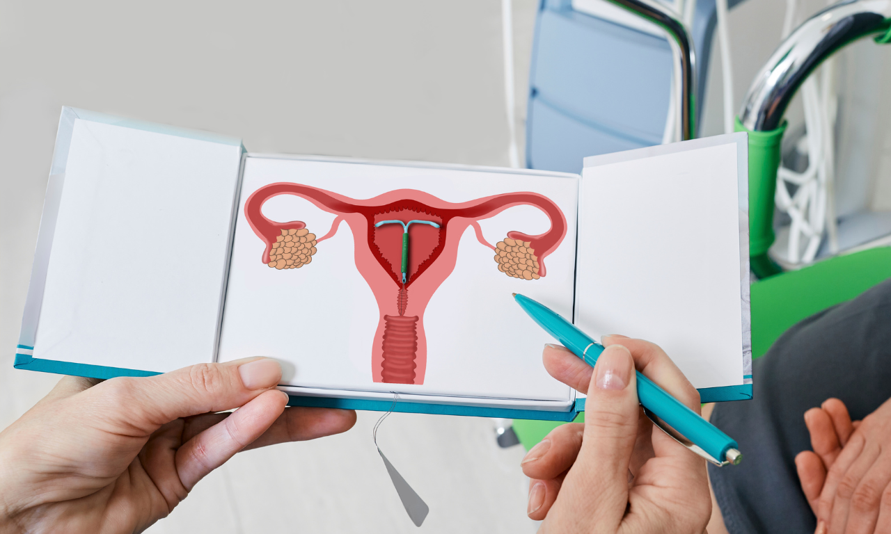 Alat Dalam Rahim Iucd Iud Klinik Uzma