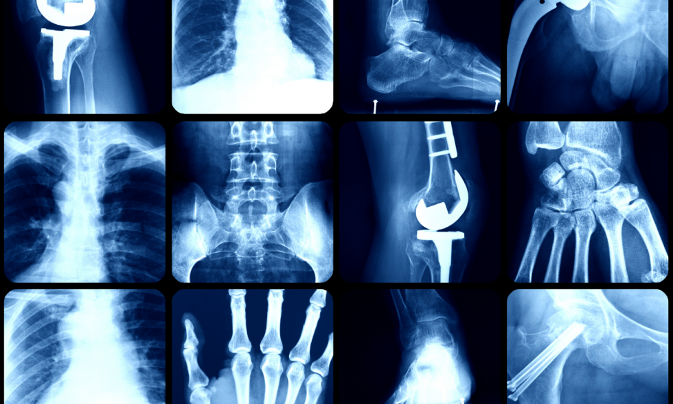 Khidmat X ray - Klinik Uzma