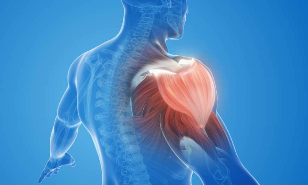 Fisioterapi Untuk Bahu Kaku (Frozen Shoulder) - Klinik Uzma